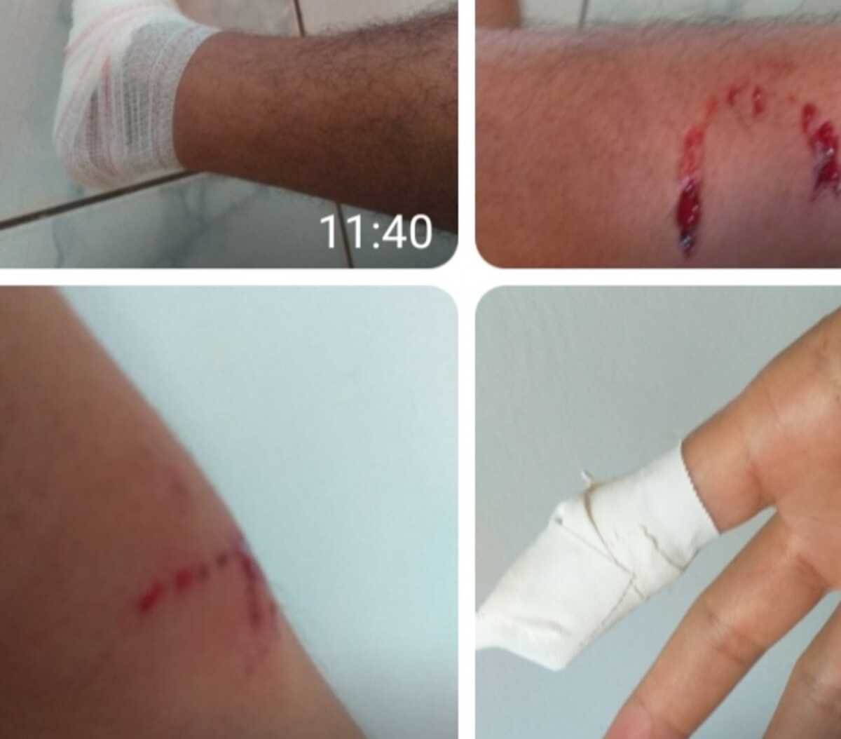 Após atacar cães, 'teiú' fere homem com mordidas em Glória de Dourados ...